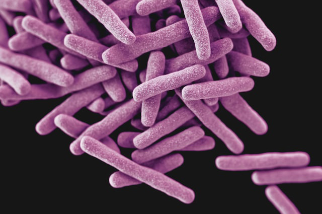 How to Eliminate Coliform and E. coli in Well Water in Florida ...